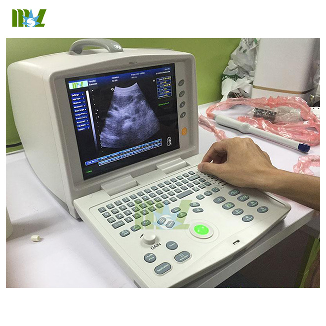PC based ultrasound device / 3D full digital laptop USG MSLPU30